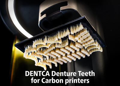 Dentca