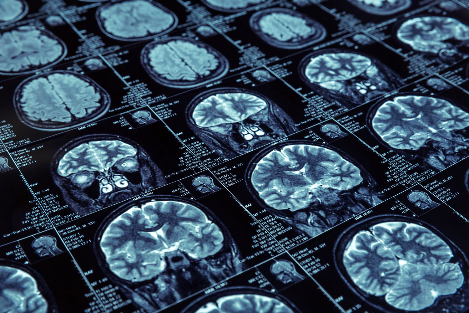 From Stanford: “Stanford psychologists simplify brain-imaging data to ...
