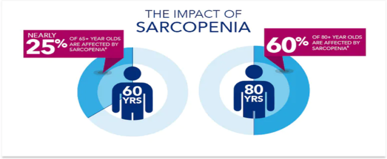 SARCOPENIA – “MUSCLE LOSS AS WE AGE” IS TOTALLY PREVENTABLE - Swim ...